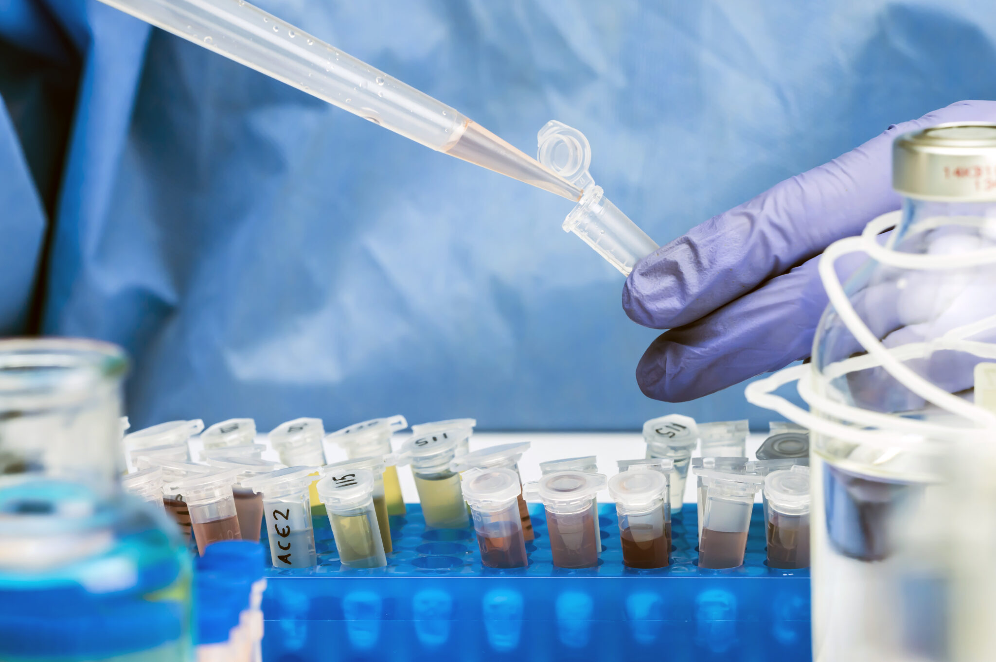 Understanding Waste Water Testing: An Environmental Safeguard