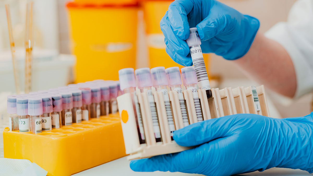 Pathology Testing Lab » Prism Calibration Centre